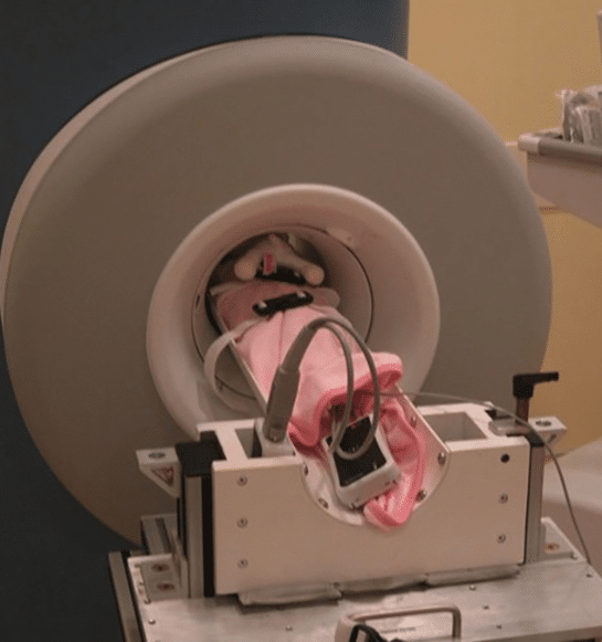 Pending MRI Page Revision - NEATCap Medical